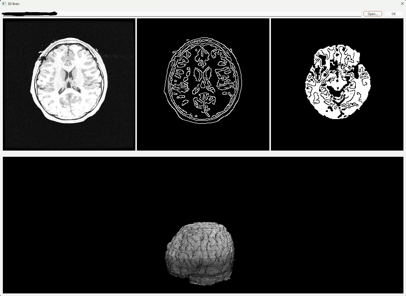 技術(Python) - 3D Brain Viewer